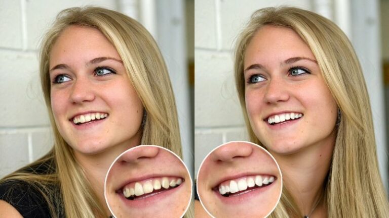 8 Best Teeth Whitening Apps to Get a Picture-Perfect Smile